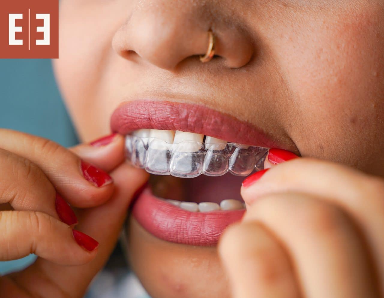 Dental Care Services Near Powder Springs GA - Esteem Dental Studio